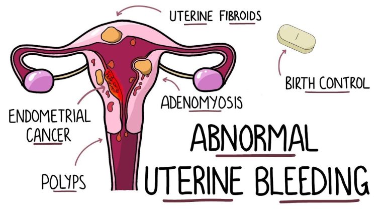 Symptoms of Uterine Problems | Uterine health warning signs